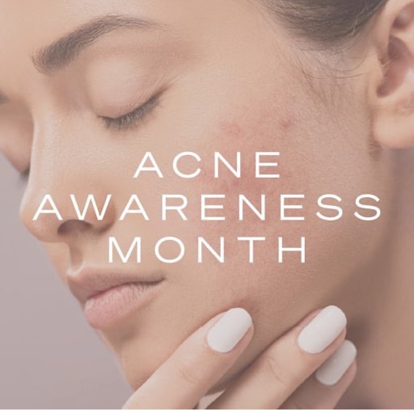 Acne Awareness Month – Skin Deep Beauty by Christine Lindsay
